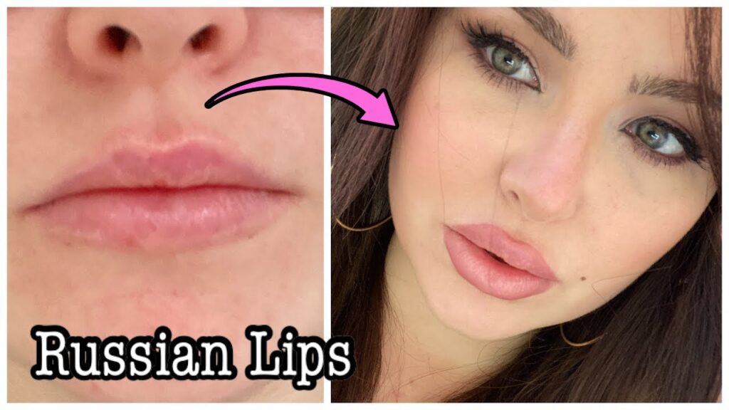 Russian lips : redessiner l'arc de cupidon pour des lèvres en cœur