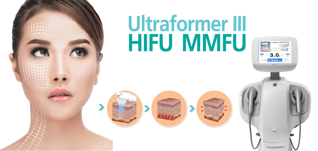 Ultraformer III : soft lift sans chirurgie avec ultrasons focalisés
