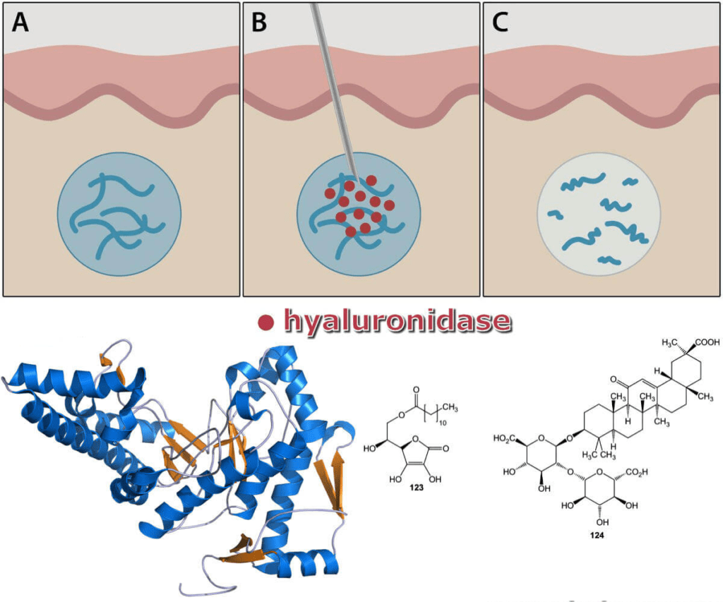 Hyaluronidase et complications aux injections d'acide hyaluronique